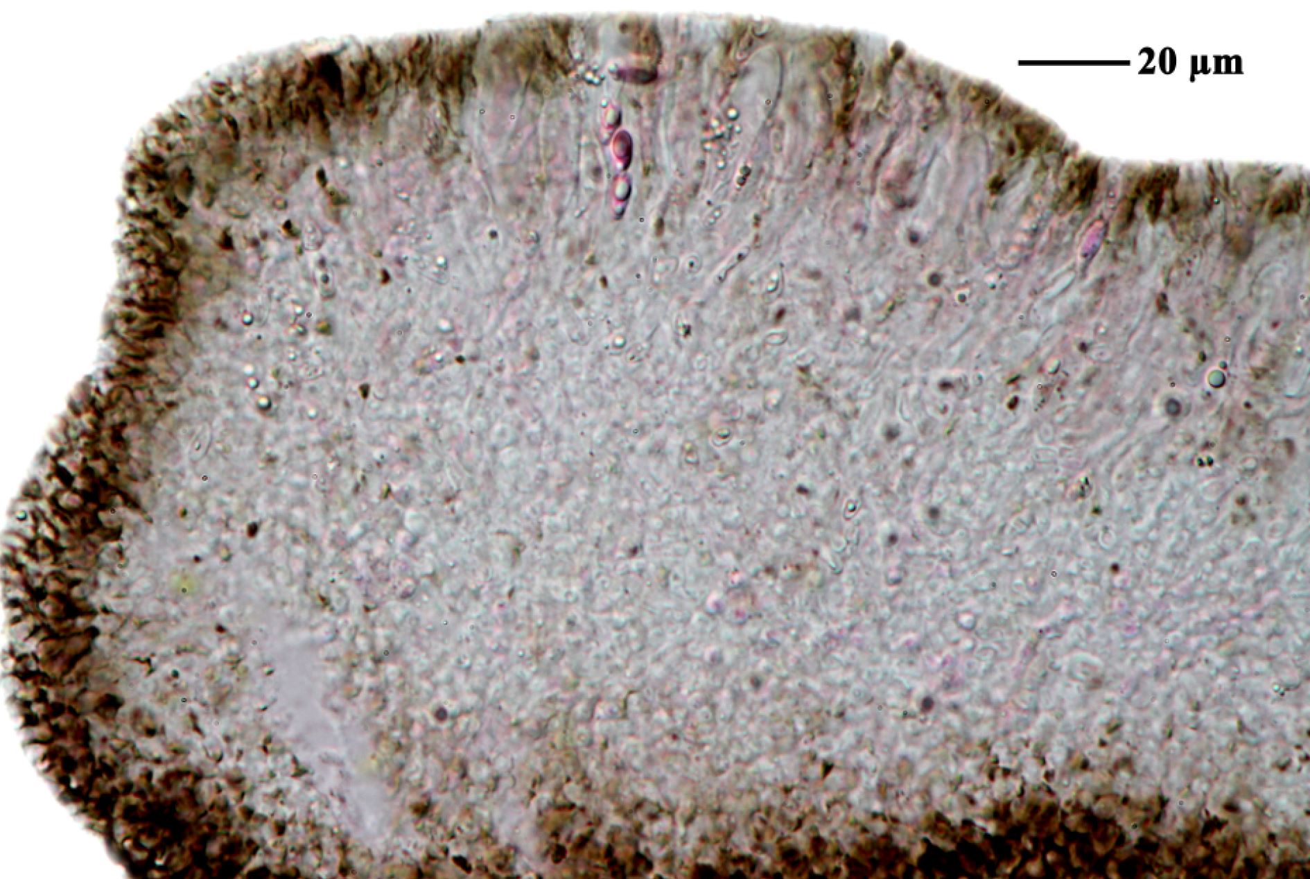 Trapeliopsis pseudogranulosa Coppins & P. James